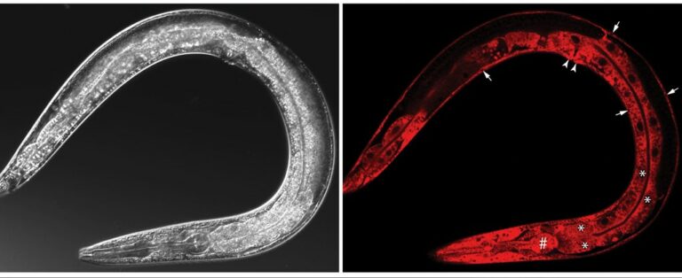 Requirement For Translocon-associated Protein (TRAP) Α In Insulin ...