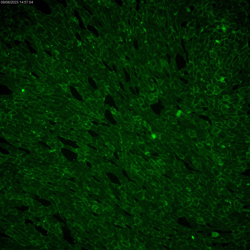 Cherry Biotech - Active Matter: From Fundamental Science to ...