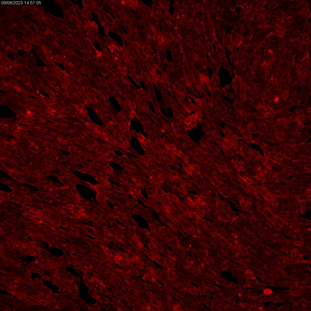 Cherry Biotech - Active Matter: From Fundamental Science to ...