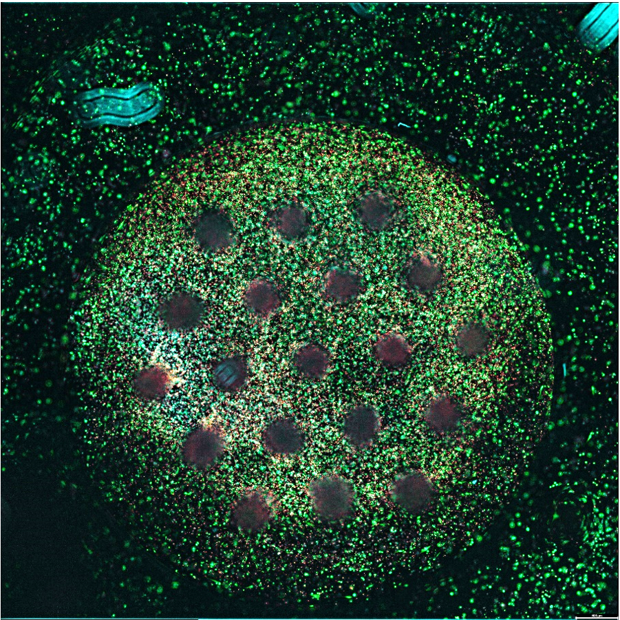 Breast Cancer 3D in Vitro Organ Model - Cherry Biotech